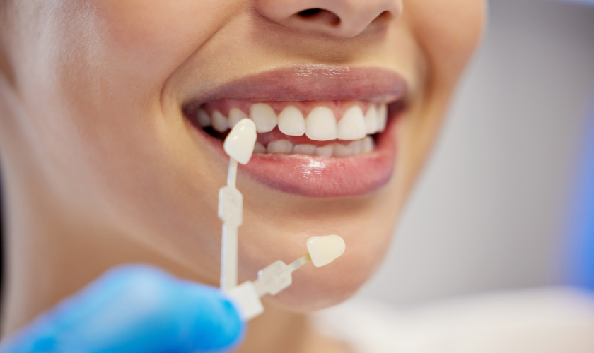Understanding Veneers and Enamel Removal